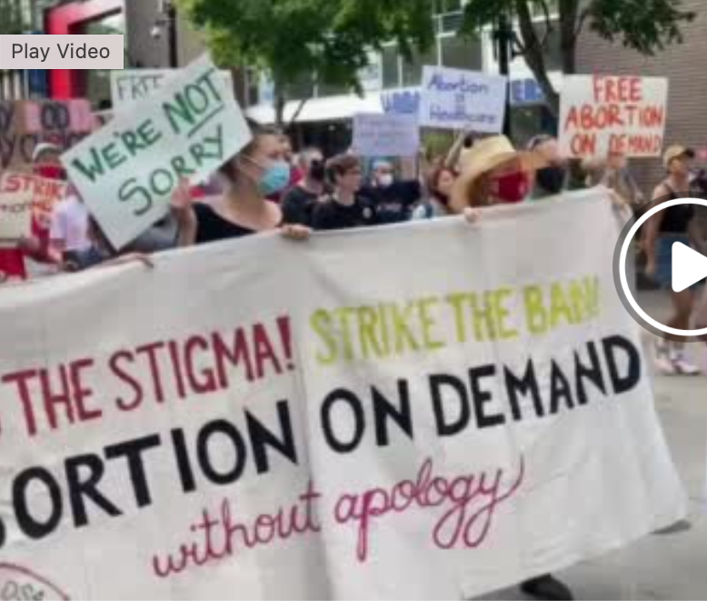 Safe, Legal & Rare – Yellow Stripes & Dead Armadillos